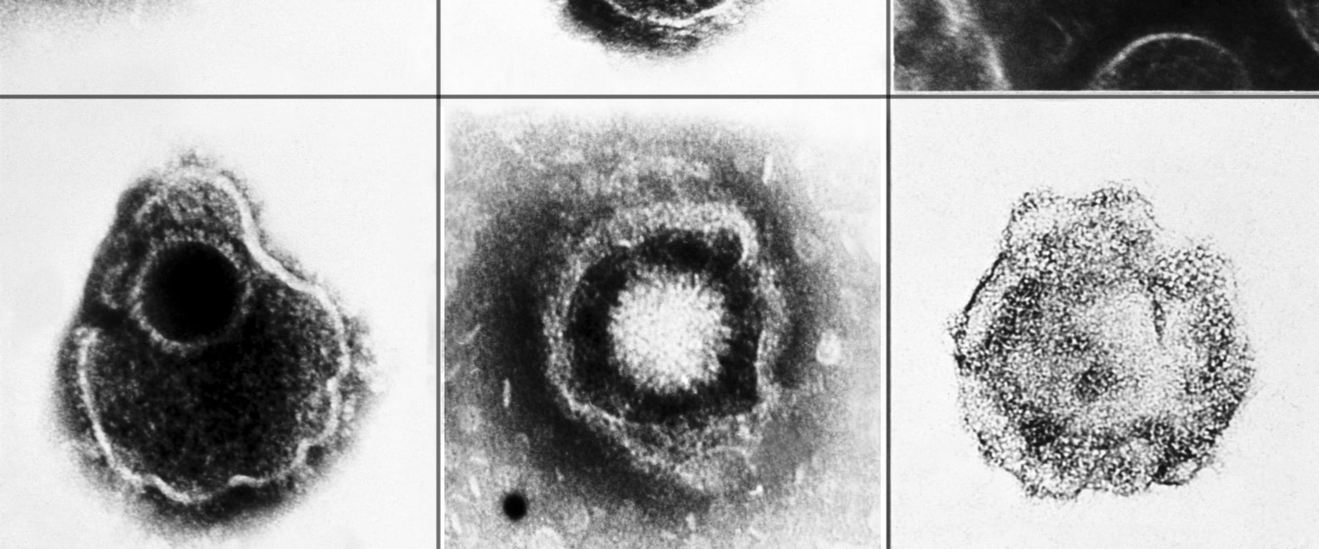 HSV-1 vs. HSV-2: Transmission and Infection Rates