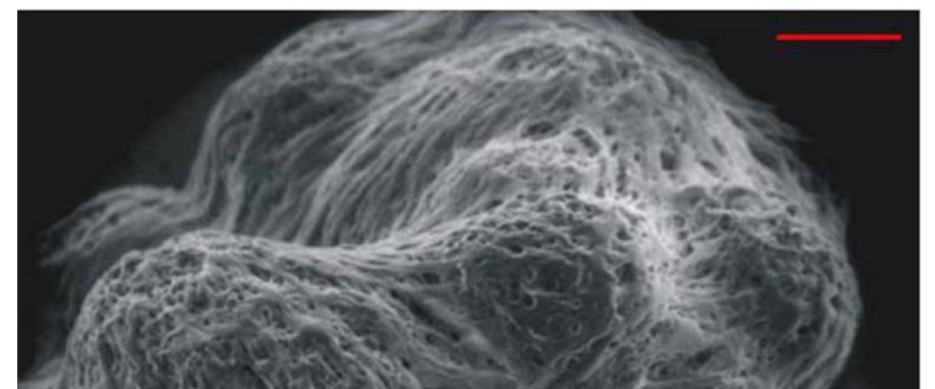 Understanding Transmission of Varicella Zoster Virus (VZV)