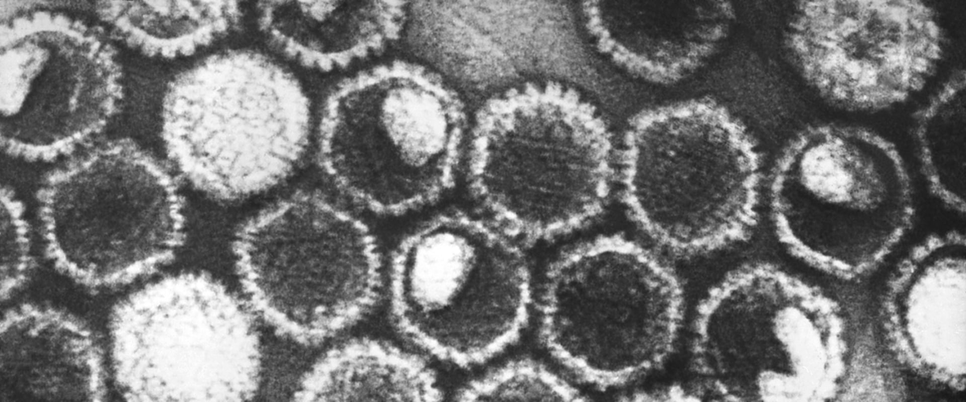 Understanding the Routes of Transmission for HSV-1 and HSV-2